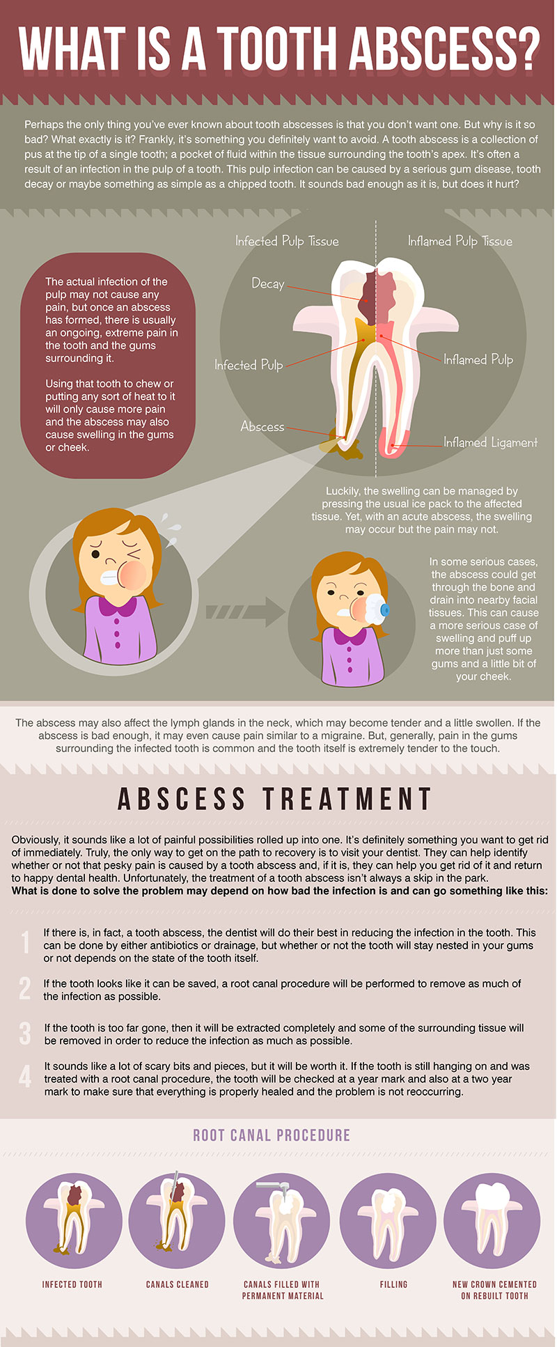 What is a Tooth Abscess?